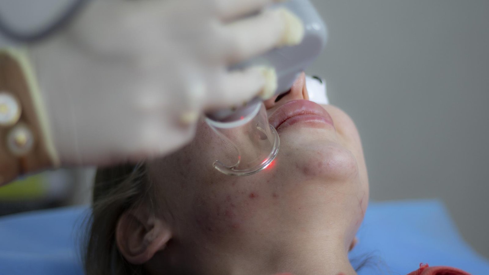 3 BENEFITS OF REJUVENATION LASER TREATMENT - Beauty Remind